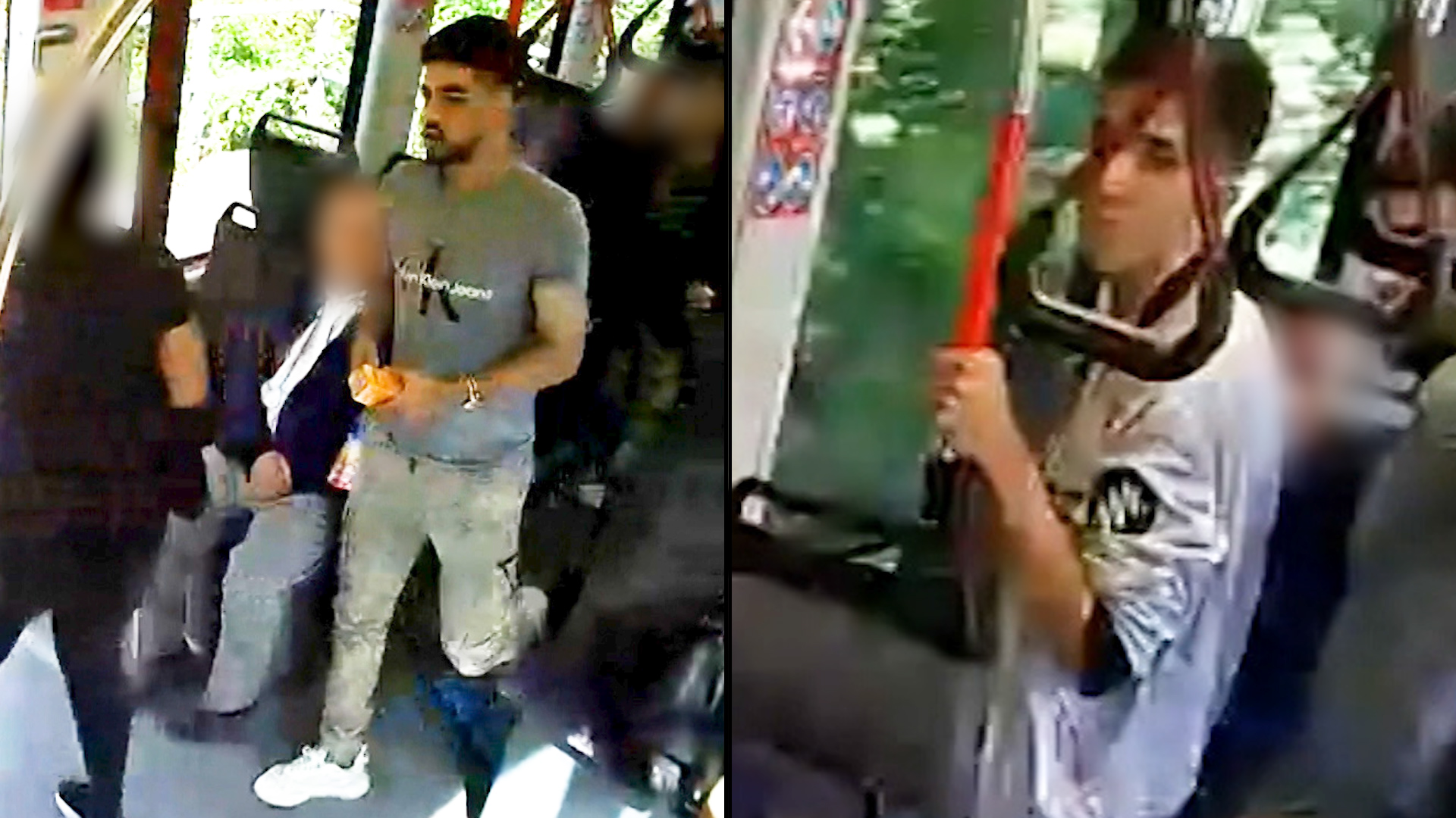 Foto’s: Man (71) loopt gebroken kaak en oogkas op na mishandeling in ...